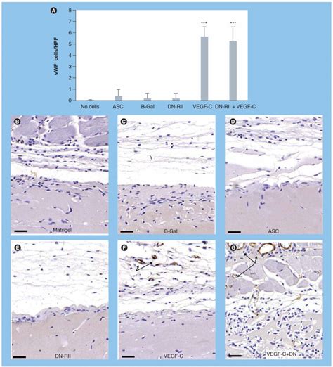 Inhibition of TGF β signaling does not augment angiogenesis in response Download Scientific