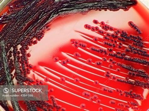 Chromobacterium Violaceum Bacterial Culture Superstock