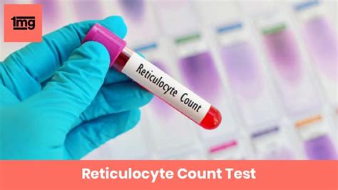 Reticulocyte Count Purpose And Normal Range Of Results 1mg