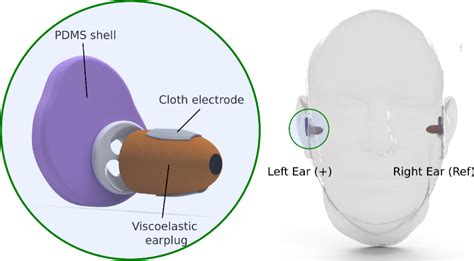 In Ear Ecg Signal Enhancement With Denoising Convolutional Autoencoders