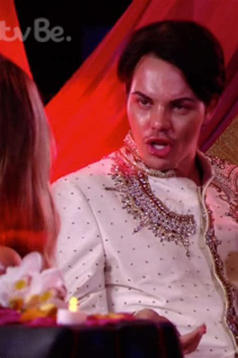 Bobby Norris Nose TOWIE Star Reveals Surgery Results But What S He Had Done To His Face OK