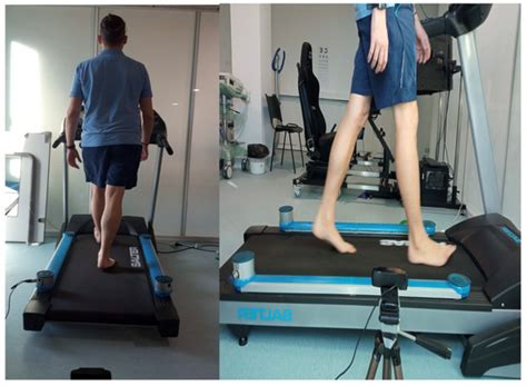 Differences In The Impact Of Plantar Fasciopathy On The Spatio Temporal Gait Parameters Between
