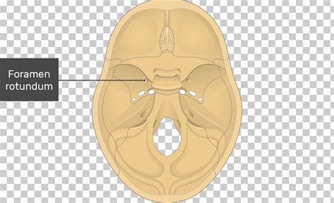 Foramen Rotundum Skull Multiple Cranial Neuropathies Anterior Skull
