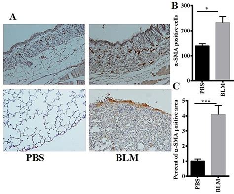 Bleomycin Increases The Expression Of α Sma In Skin And Lung Tissues Of Download Scientific