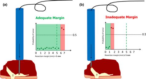 Specimen‐driven Intraoperative Assessment Of Resection Margins Should