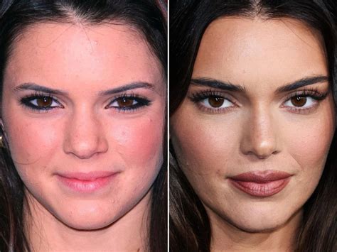 Theqoo Kendall Jenner Shares Why Her Nose Looks Different Directly