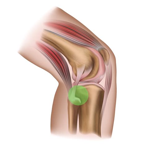 Dealing With Fibular Head Pain Causes And Solutions Sport Doctor London