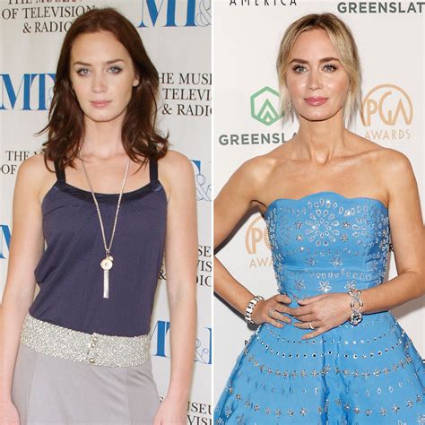 Has Emily Blunt Had Plastic Surgery Transformation Photos Life And Style