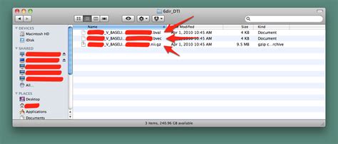 converting dicom images to nifti images structural neuroimaging with os x