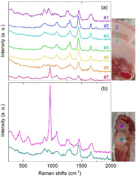 Figure 1 From Infrared Raman Spectroscopy Enables Noninvasive Biochemical Assessment Of Skin