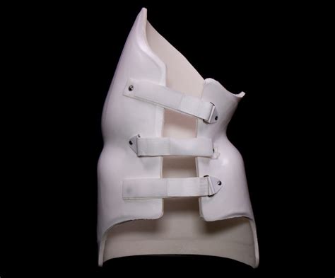 Charleston Bending Brace Nighttime Treatment Of Adolescent Scoliosis