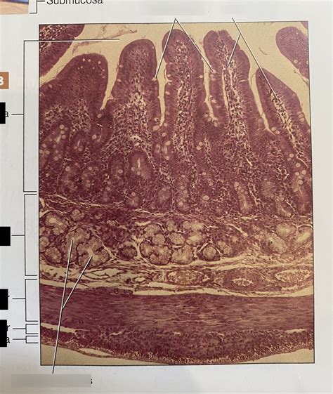Duodenum Histology Diagram Quizlet