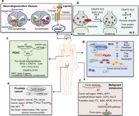 Spatial Transcriptomics Applications Methods Challenges