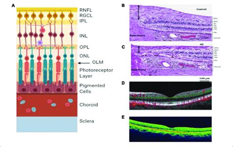 Retinal Layers And Imaging A The Individual Layers Of The Retina