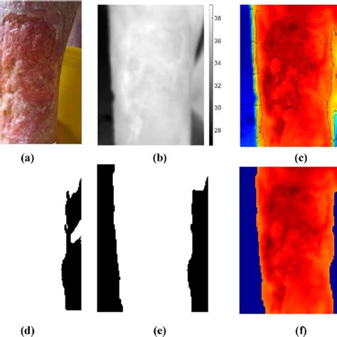 Thermal Image Pre Processing Steps A Rgb Image B Thermal Image