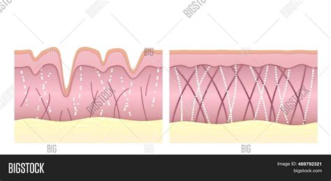 Collagen Elastin Image And Photo Free Trial Bigstock