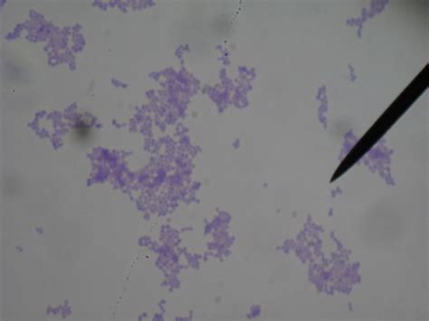 Streptococcus Pyogenes Microscopic Streptococcus Pyogenes Microscopic