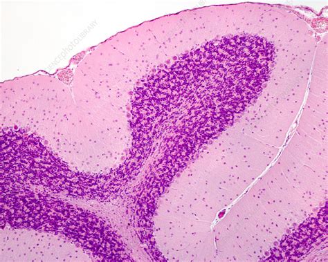 Cerebellar Cortex Histology Human Cerebellar Cortex Photomicrograph