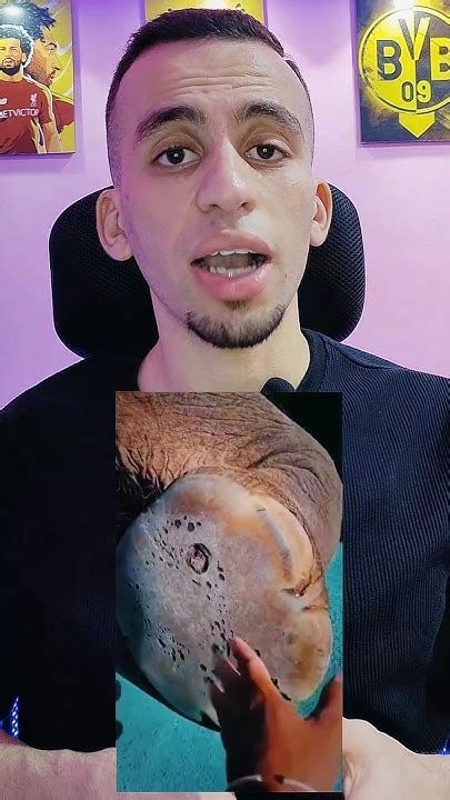 رجل الفيل الحقيقة 🤔 Youtube