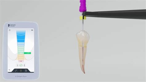 X Smart Pro Getting Started Apex Locator Only Mode Youtube