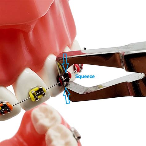 High Quality Orthodontic Pliers For Braces And Wire Adjustments Artman