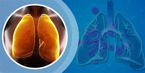 기관지 확장증 원인 증상 치료법 알아보기 쉬운설명 럽유어바디