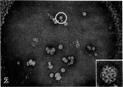 Magnesium Uranyl Acetate Sds At Joyce Hartmann Blog