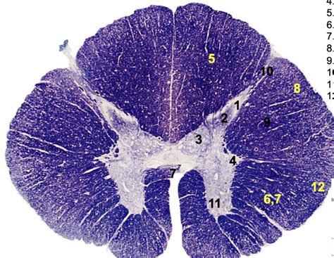 T10 Spinal Cord Diagram Quizlet