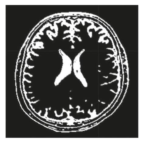 Ad Segmented Images Using Our Proposed Method Eh Segmented