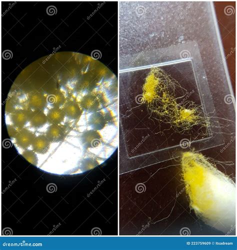 Microscopic View Of The Pollen Of Butternut Squash Stock Image Image