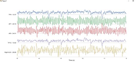 Viewing Your Brain With Muse A Tutorial On How To Use Muse To Record