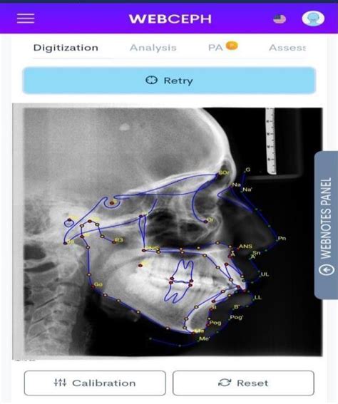 automatic tracing by webceph app download scientific diagram