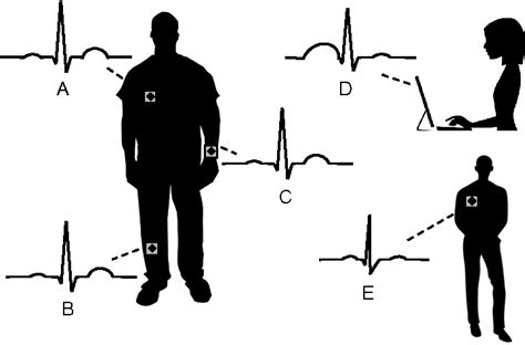 Figure 1 From Design Of Secure Ecg Based Biometric Authentication In