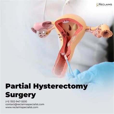 The Essential Guide To Partial Hysterectomy Surgery