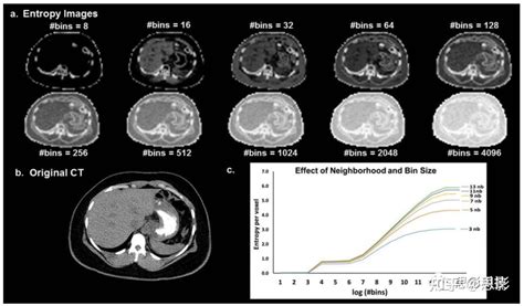 精准医学中的深度学习和影像组学 知乎