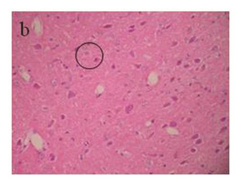 Microstructure Of Brain Tissue Under Light Microscope With 200 ×