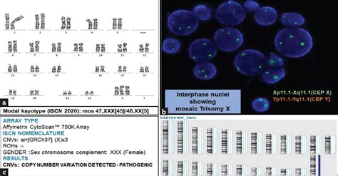 Unravelling The Impact Of An Additional Sex Chromosome In An Journal Of Human Reproductive