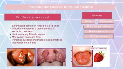 Faringitis Janeth Guadalupe Montalvo Sanchez 4apptxpdf