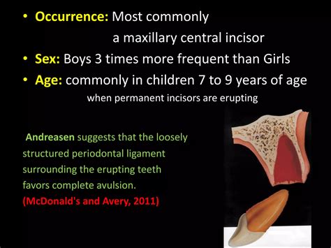 Avulsion Of Permanent Teeth Pptx