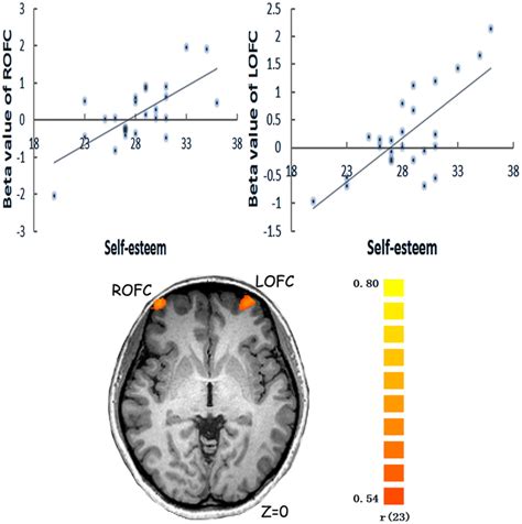 prediction of self esteem by attitude related neural activity showed