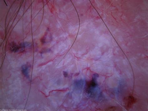 Global Skin Path Atlas Diagnosis Detail