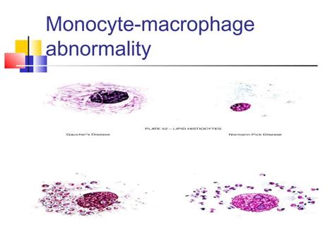 Abnormalities Of Wbc Ppt