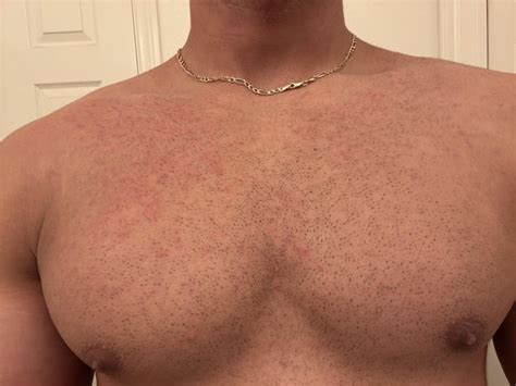 Red Bumps From Shaving Chest Rskin