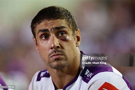 Tom Learoyd Photos And Premium High Res Pictures Getty Images