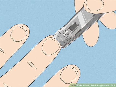 Ways To Stop Scratching Irritated Skin WikiHow