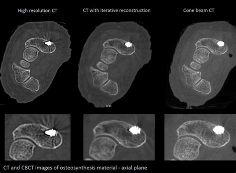 High Resolution Ct Ct With Iterative Reconstruction And Conebeam Ct Download Scientific