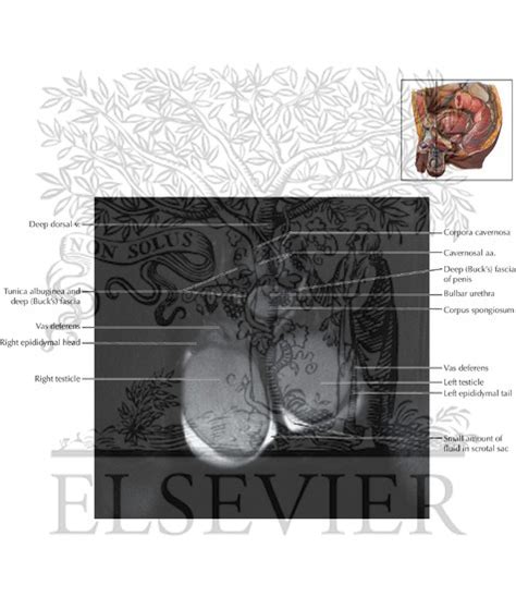 Scrotum And Testes Coronal