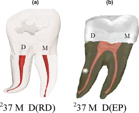 A New System For Classifying Tooth Root And Canal Anomalies Ahmed 2018 International