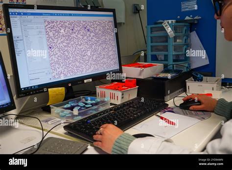 Medical Analysis Laboratory Biomedical Analysis Technicians Visual Analysis And Interpretation