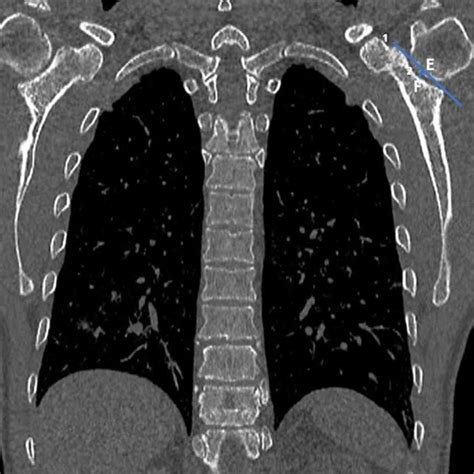 Demonstration Of Measurement Of Length Between A And B And Breadth Of